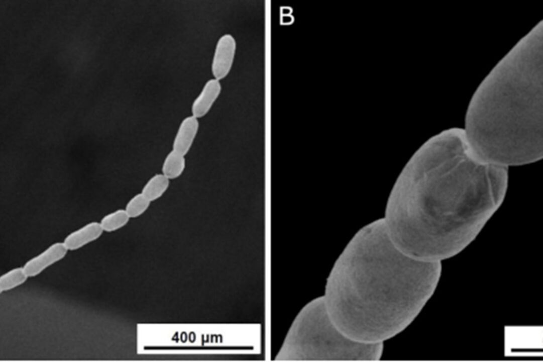 Descoberta a maior bactéria do mundo: é do tamanho de uma pestana ...