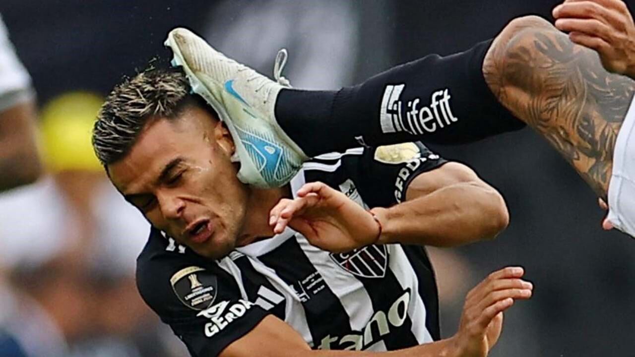 A brutal patada na cabeça que ditou expulsão no Botafogo no primeiro ...
