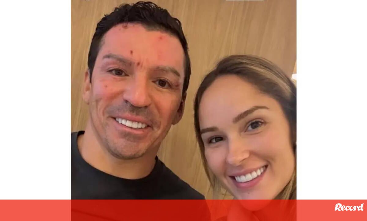 Lúcio mostra sinais de recuperação após queimar 18 por cento do corpo ...